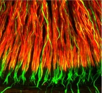 Huth Lab - Exploring Ion Channels and Diseases - Huth Lab - Biophysics ...